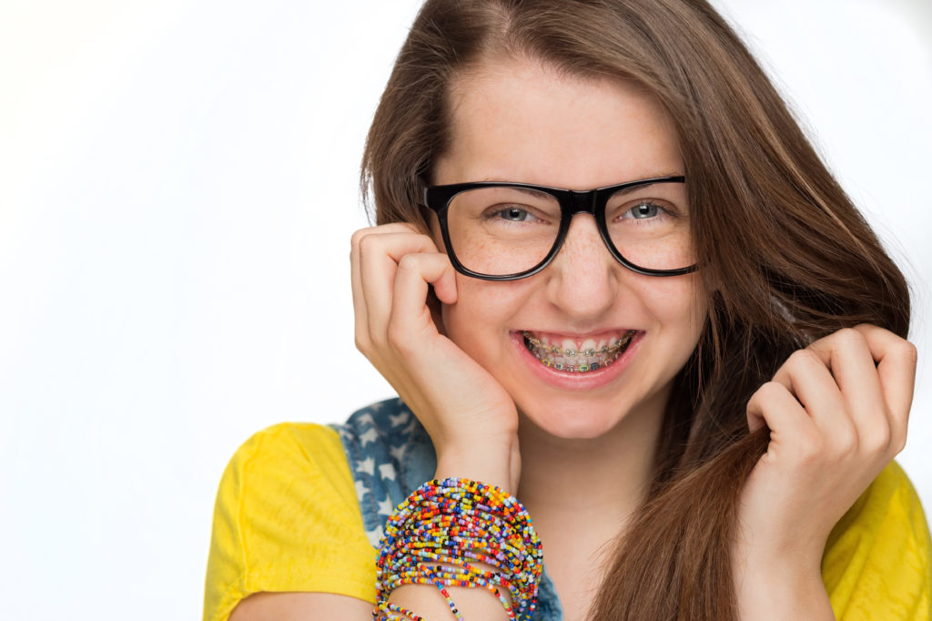 How Long Will You Be In Braces? - CHT Orthodontics
